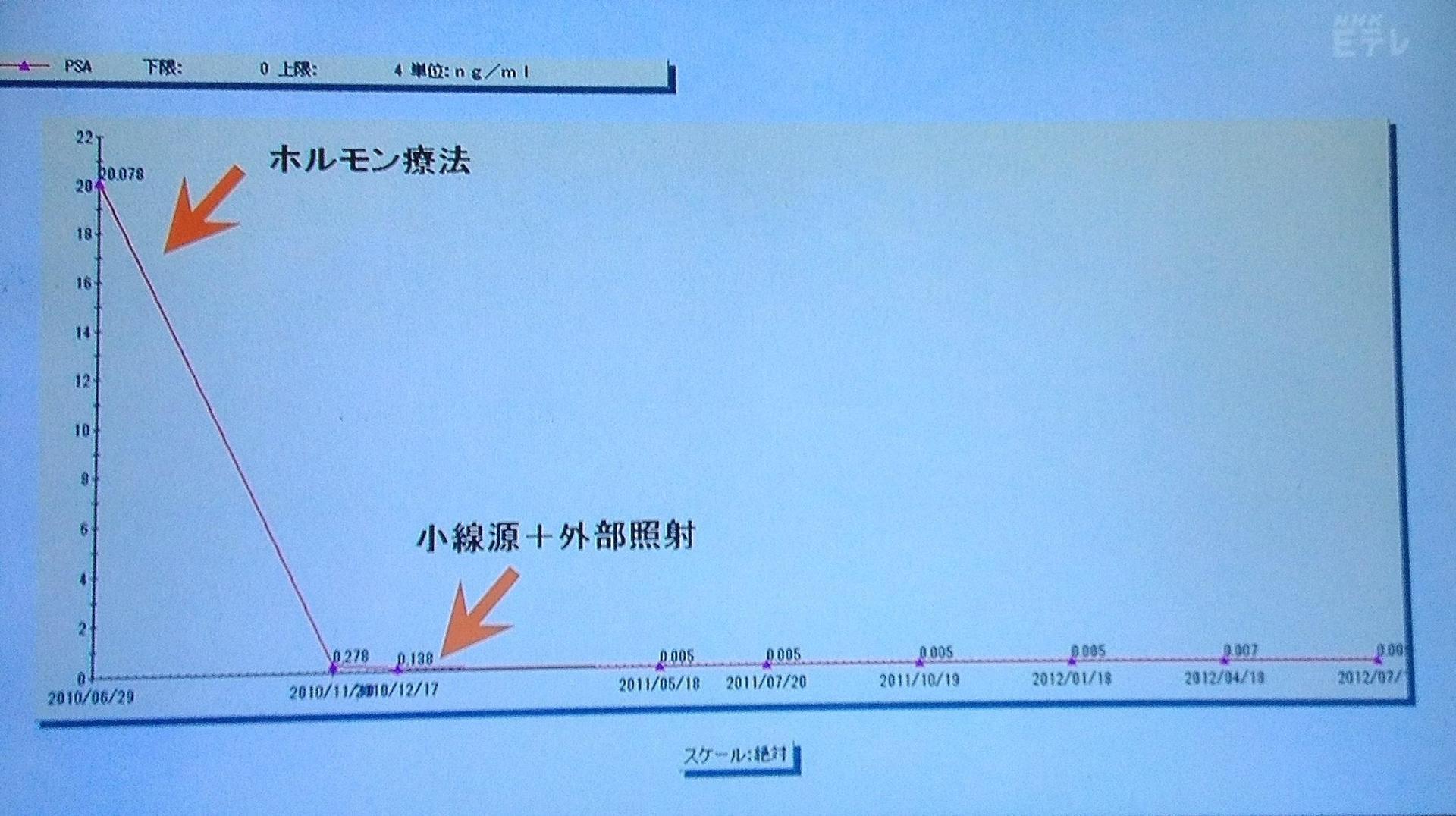 「もっと知りたい前立腺がん」～あなたに合った治療の選択～TVシンポジウムより: OTSUKYONのスローライフ♪と鉄道日記☆彡